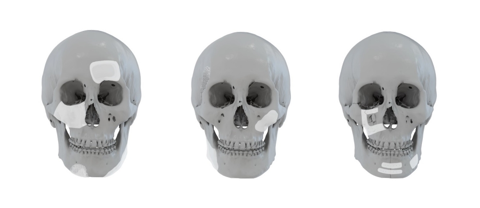 CGBio set to develop next-generation patient-customized artificial ...