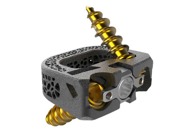 Innosys Receives US FDA Approval for ‘UniSpace,’ a Cervical Cage ...